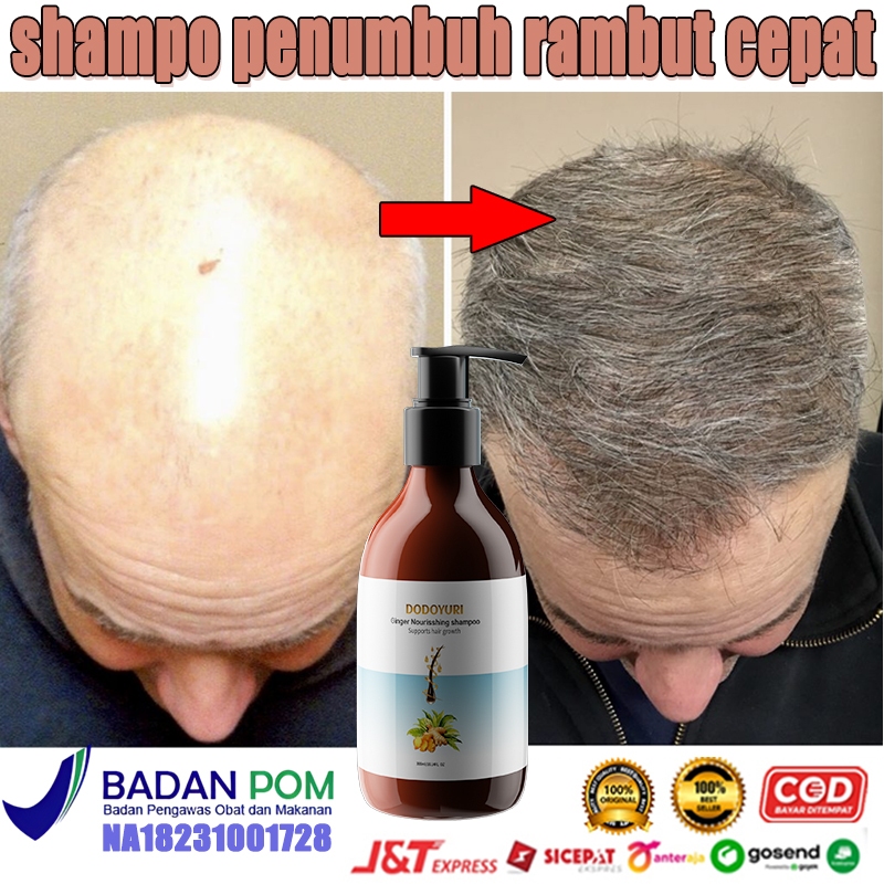 Jual Shampoo penumbuh rambut cepat Penumbuh rambut botak anti vitamin ...