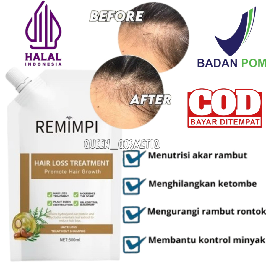 Jual shampo remimpi hair loss treatment anti hair fall penumbuh rambut ...