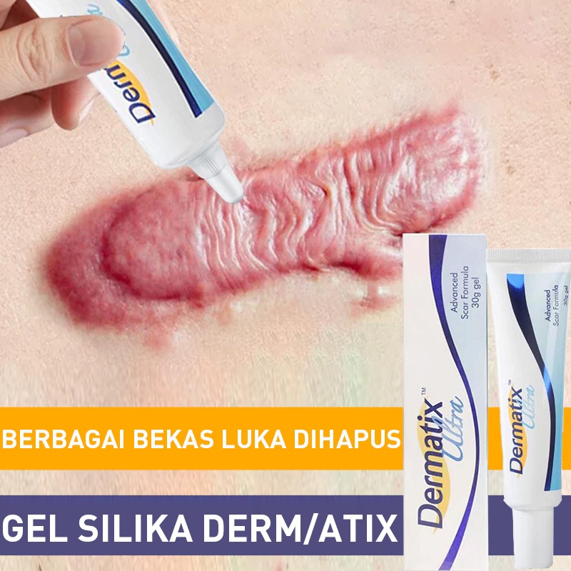 Jual Dermatix Penghilang Bekas Luka / Dermatix Ultra Gel 15gr Obat ...