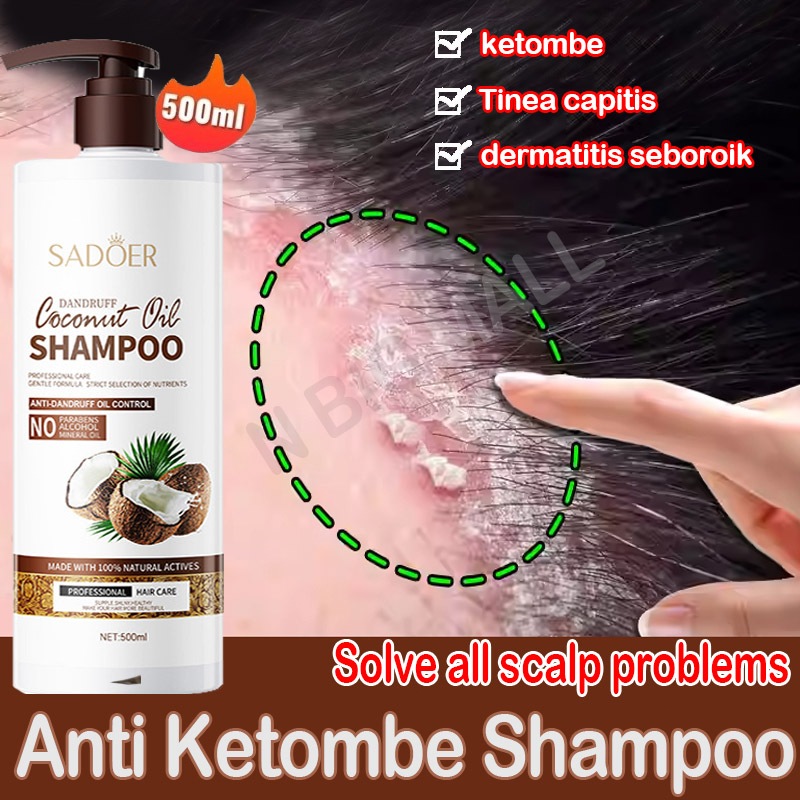 Jual Shampo anti ketombe ampuh Penghilang Ketombe gatal Kulit kepala gatal Sampo anti gatal dan ...