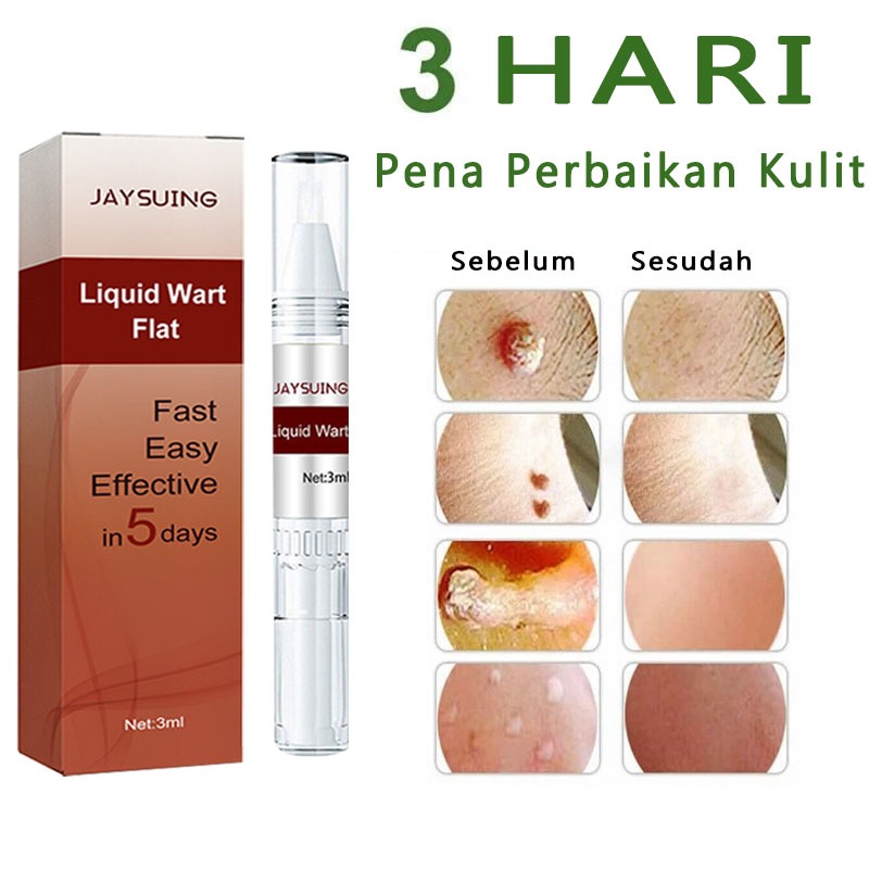 Jual obat penghilang kutil dan obat penghilang tahi lalat Wart Removal ...