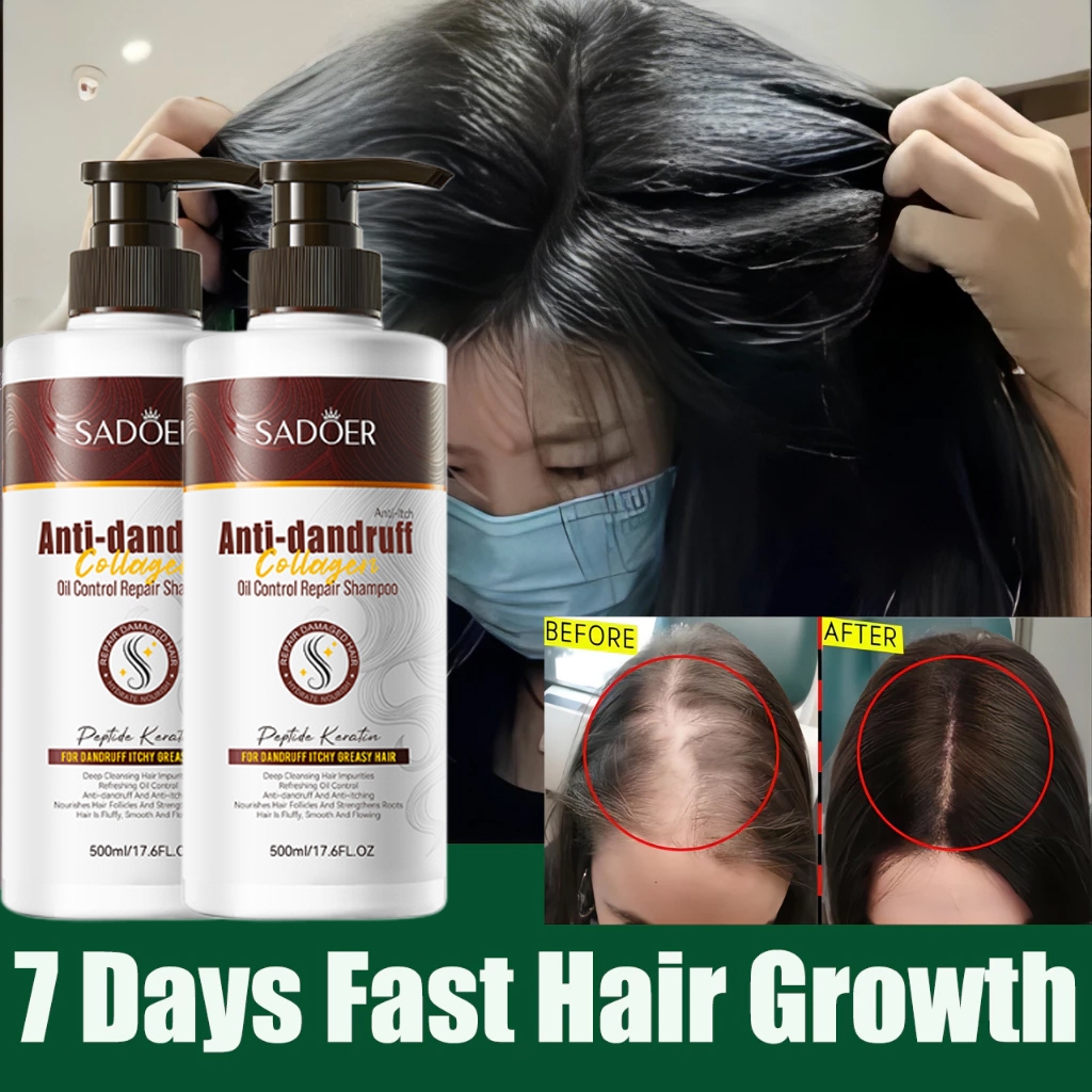 Jual Shampoo Anti Ketombe Dan Rontok 500ml Anti Rambut Rontok Dan Mengontrol Minyak Singkirkan ...