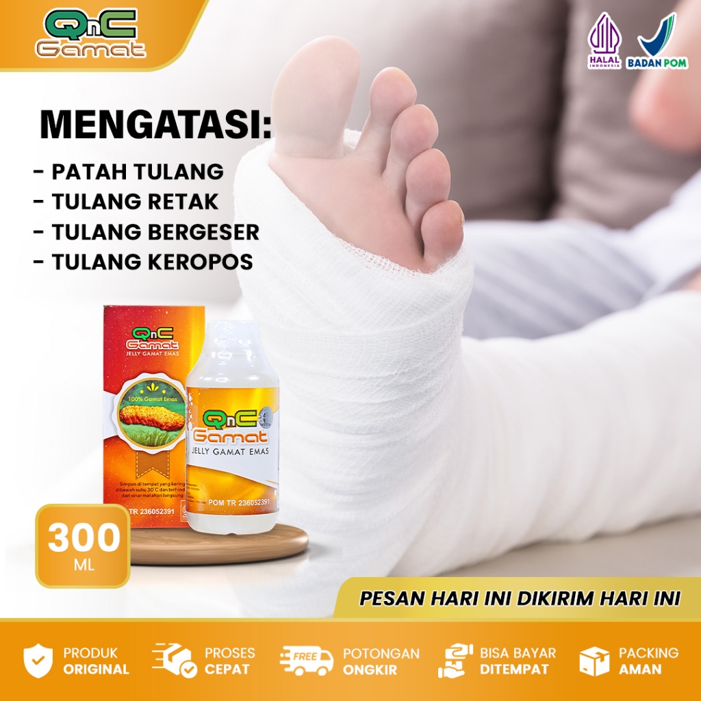 Jual Obat Patah Tulang, Tulang Remuk, Tulang Retak, Tulang Bergeser ...