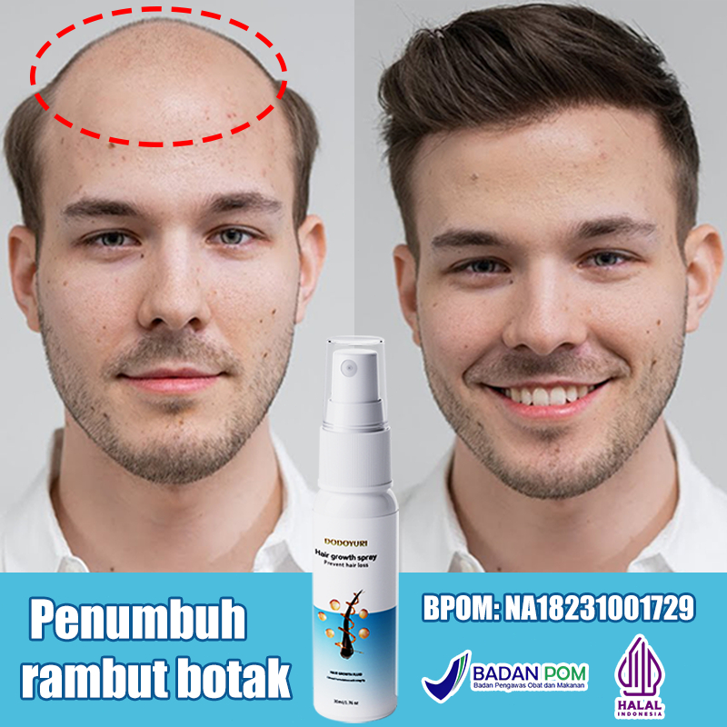 Jual Serum penumbuh rambut Penumbuh rambut botak Obat penumbuh rambut ...