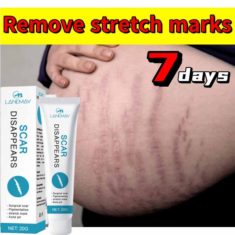 Jual Scar removal gel Salep penghilang bekas luka Penghilang bekas ...