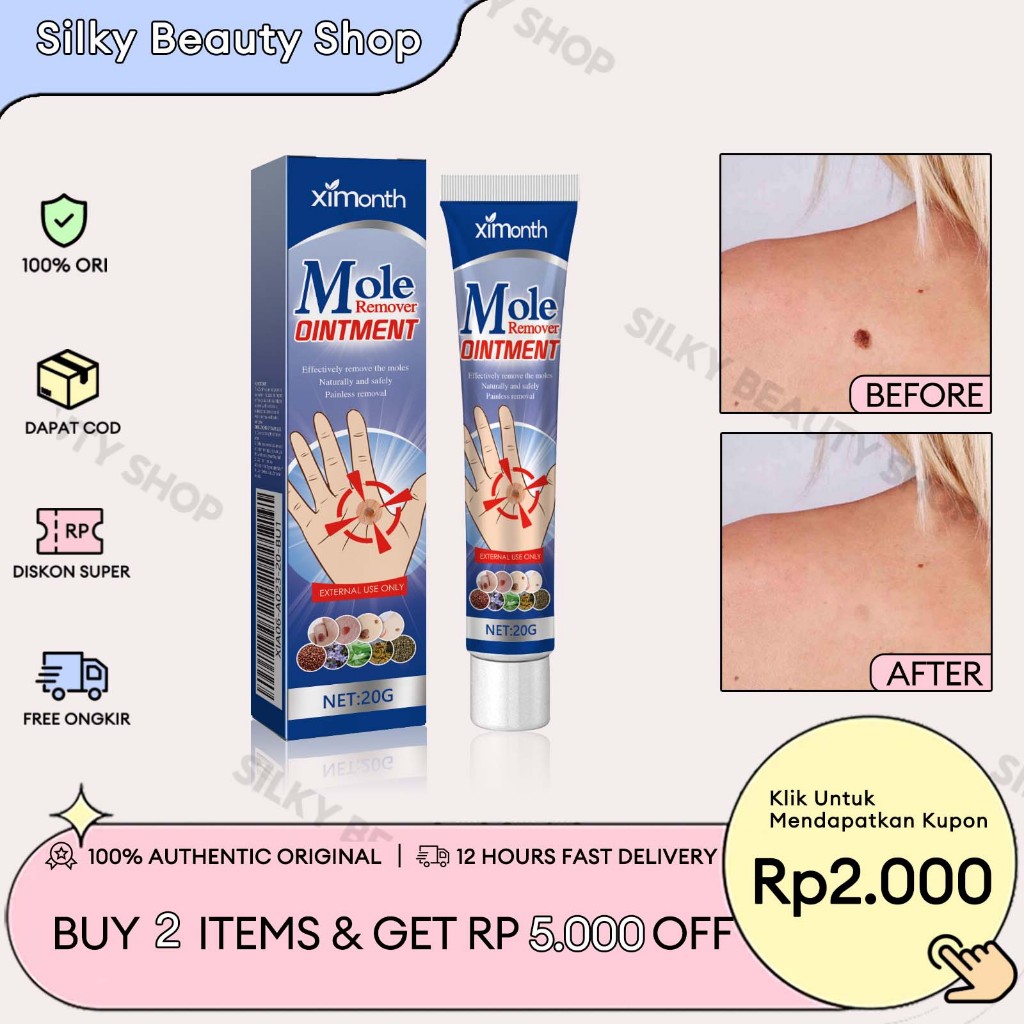 Jual Ximonth【Beli 2 Gratis 1/COD/ORI】Mole Remove Cream 20g Obat Kutil ...