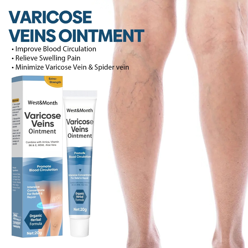 Jual West&Month Krim Varises 20g Meningkatkan Sirkulasi Darah Dan ...