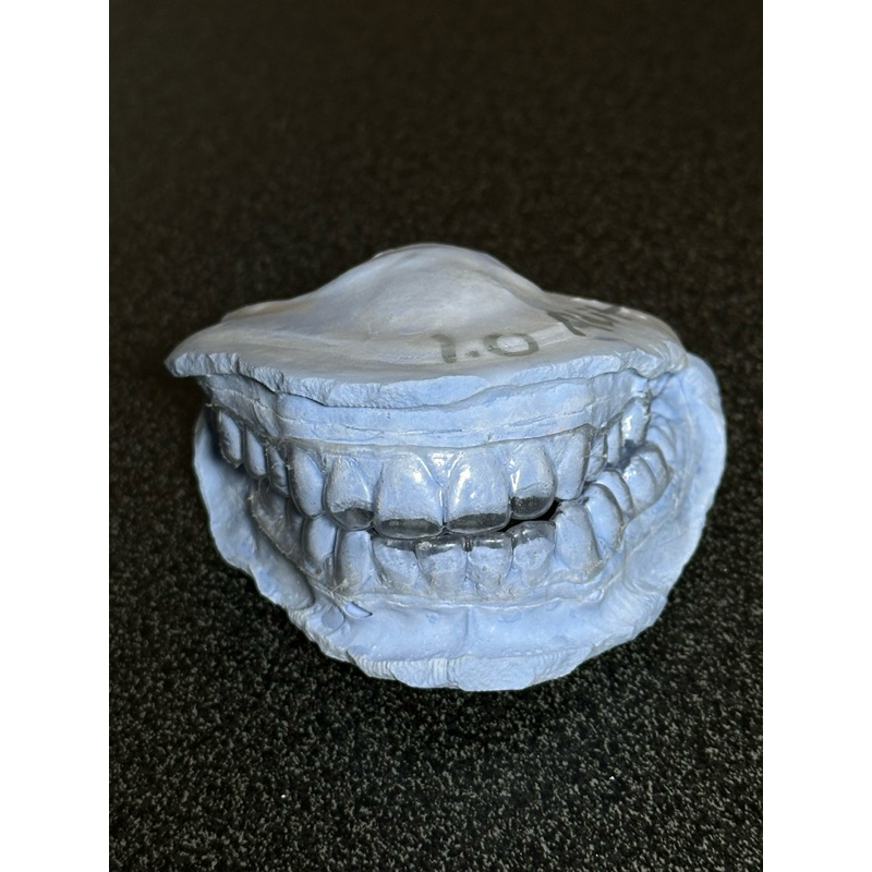 Jual Pembuatan Retainer gigi 1.0 mm | Shopee Indonesia