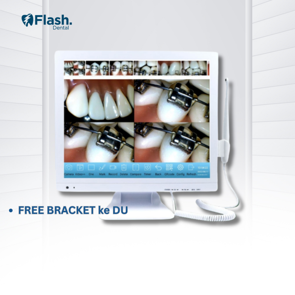 Jual Intraoral Camera MLG - Flash Dental | Shopee Indonesia