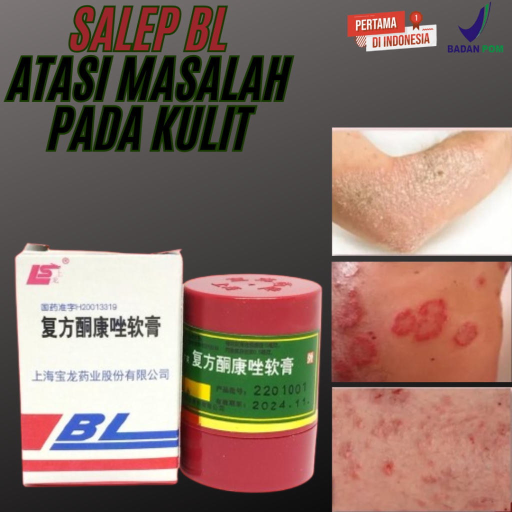 Jual (JUAL) SALEP BL ORIGINAL salep asli atasi gatel kutu air eksim ...