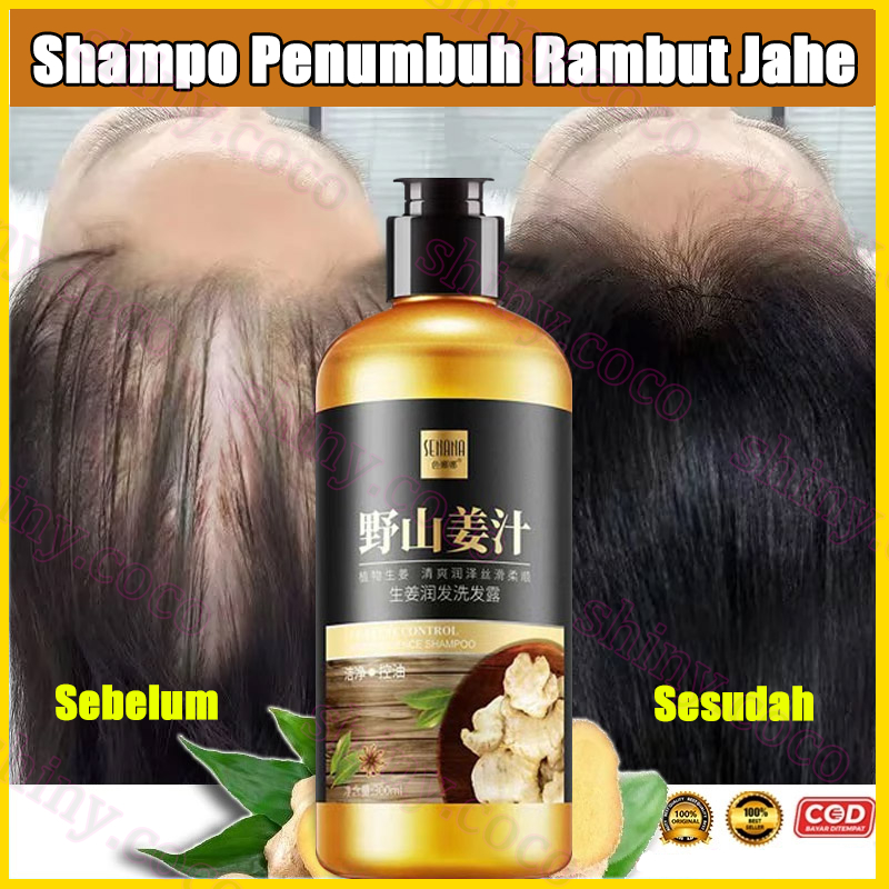 Jual 300ml Shampo Penumbuh Rambut Cepat Ginger Shampoo Original pertumbuhan rambut Pengendalian ...