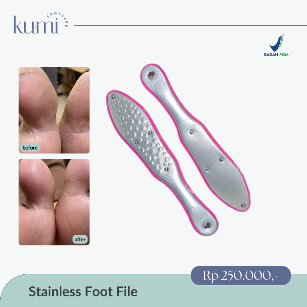 Jual Stainless Foot File / Pedicure / Kapalan / Kaki Pecah-Pecah ...