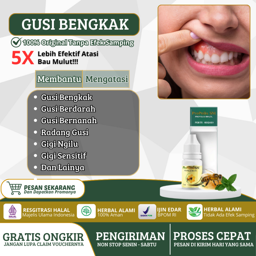 Jual Obat Gusi Bengkak Berdarah Sariawan Gigi Berlubang - PROPOLIS SM ...