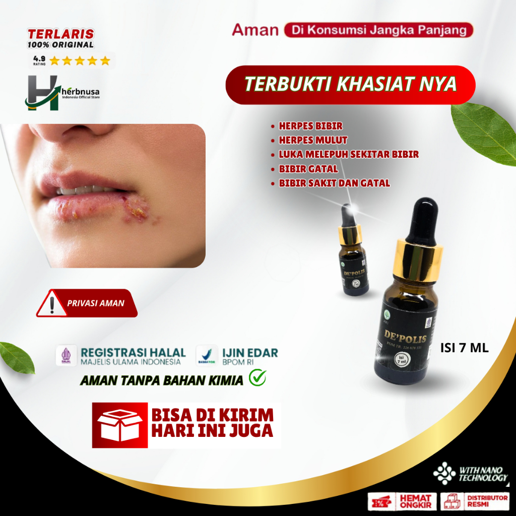 Jual Obat Herpes Bibir, Herpes Mulut, Luka Melepuh Sekitar Bibir, Bibir ...
