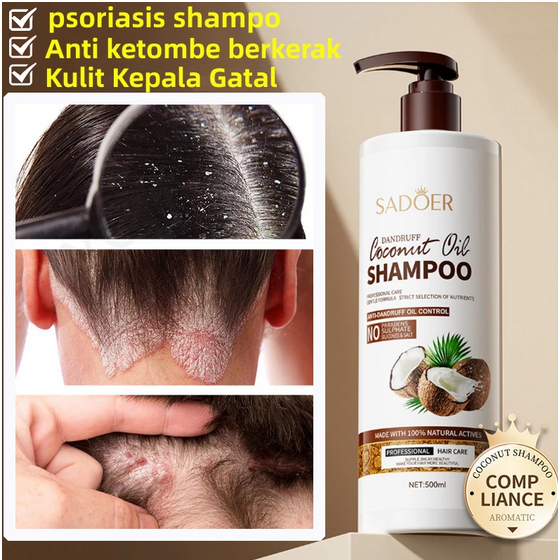 Jual Shampoo Minyak Kelapa Shampo Anti Ketombe: Penghilang Ketombe Berkerak dan Gatal, Merawat ...