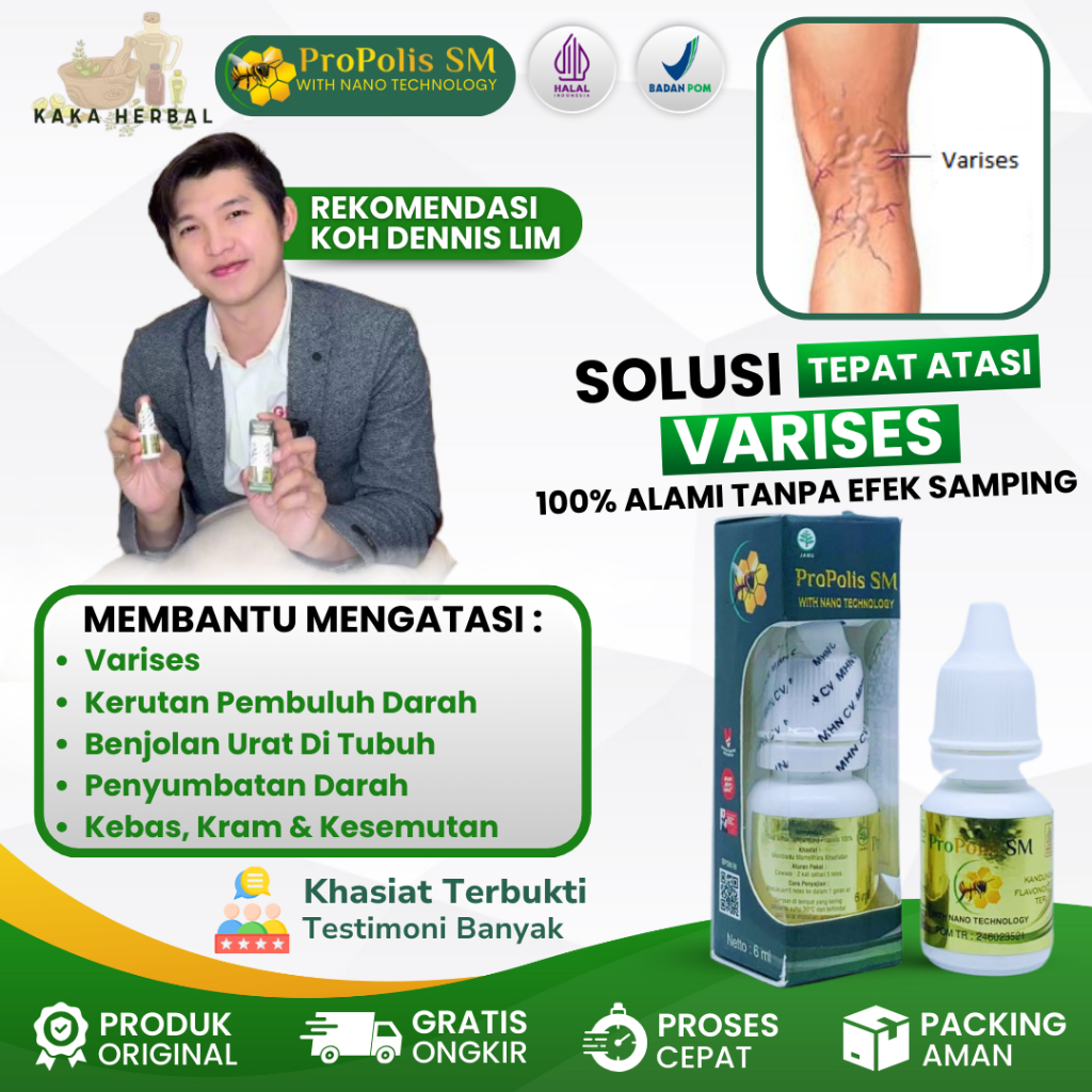 Jual Kaka Herbal - Obat Varises, Obat Varises Alami, Penghilang Varises ...