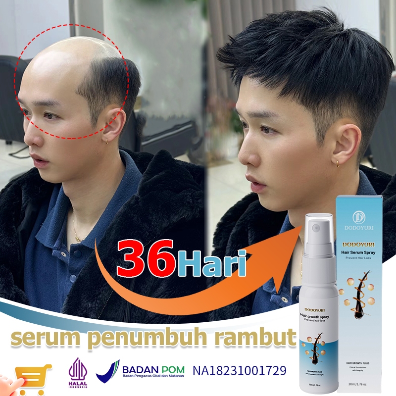 Jual DODOYURI Minyak penumbuh rambut cepat Penyubur rambut Penumbuh ...