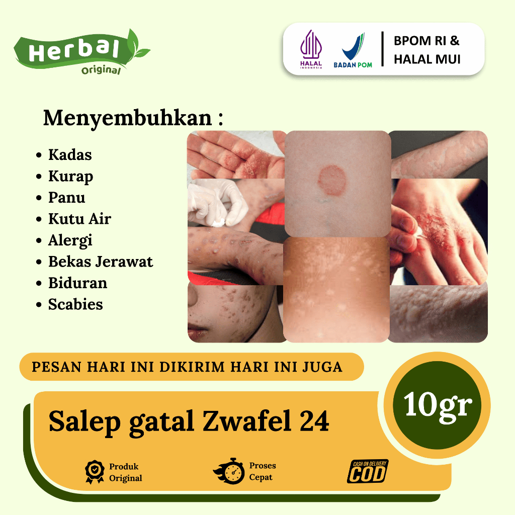 Jual Salep 2-4 Zwafel Obat Gatal untuk Jamur Kulit Mengandung Belerang ...