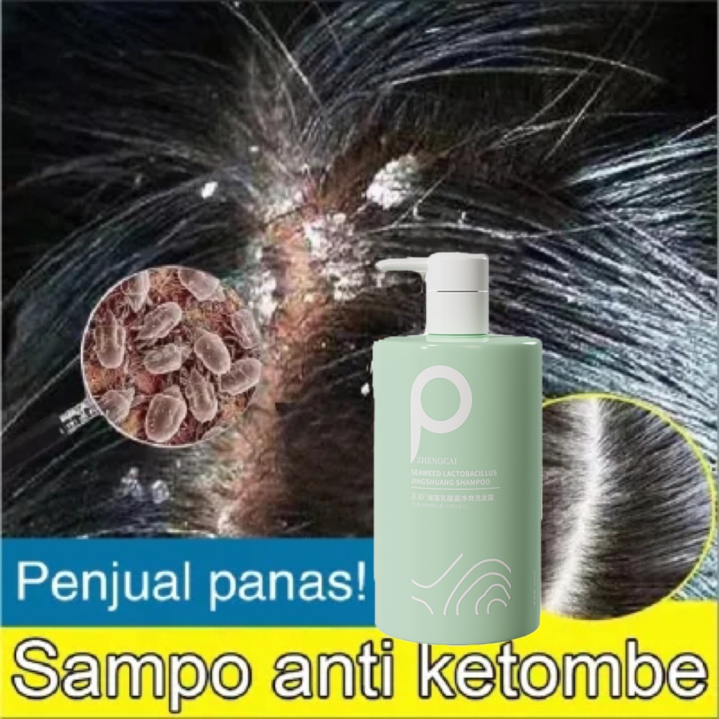 Jual Shampoo anti ketombe Shampoo psoriasis Penghilang ketombe anti gatal Sampo ketombe berkerak ...