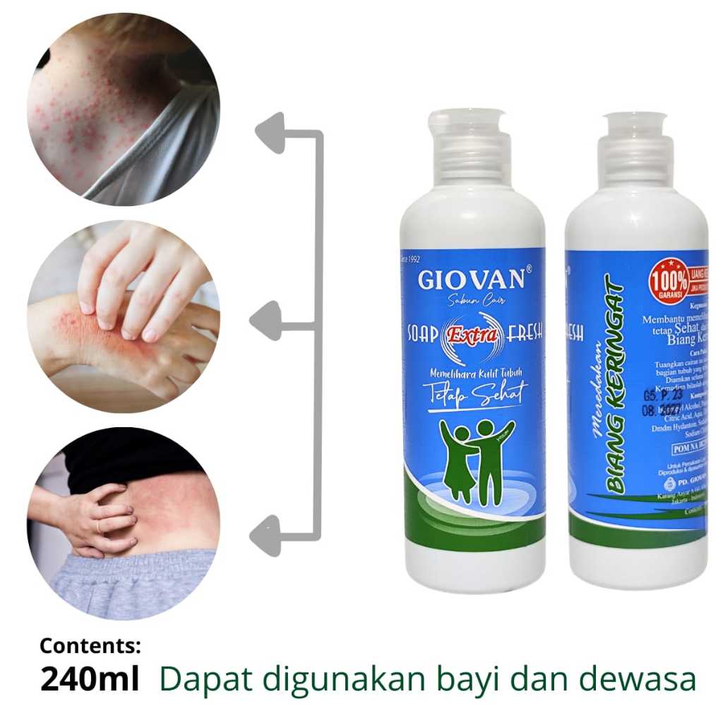 Jual Giovan 240ml Soap Fresh Giovan Sabun Mandi Cair Untuk Masalah ...