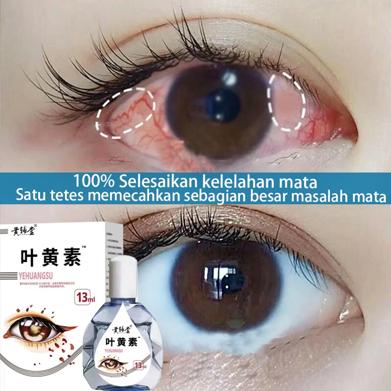 Jual Obat Mata 13ml Obat Mata Katarak Menyembuhkan Mata kering Sakit ...