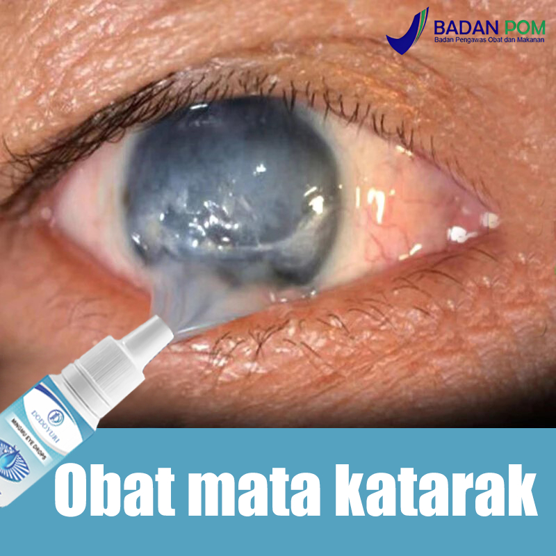 Jual Tetes mata katarak Obat mata katarak Obat mata minus Obat tetes ...