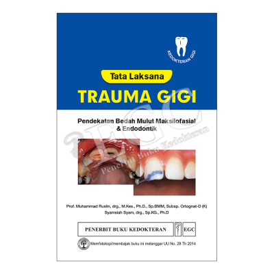 Jual Buku ORIGINAL - Buku Tata Laksana TRAUMA GIGI Pendekatan Bedah Mulut Muhammad Ruslin EGC ...