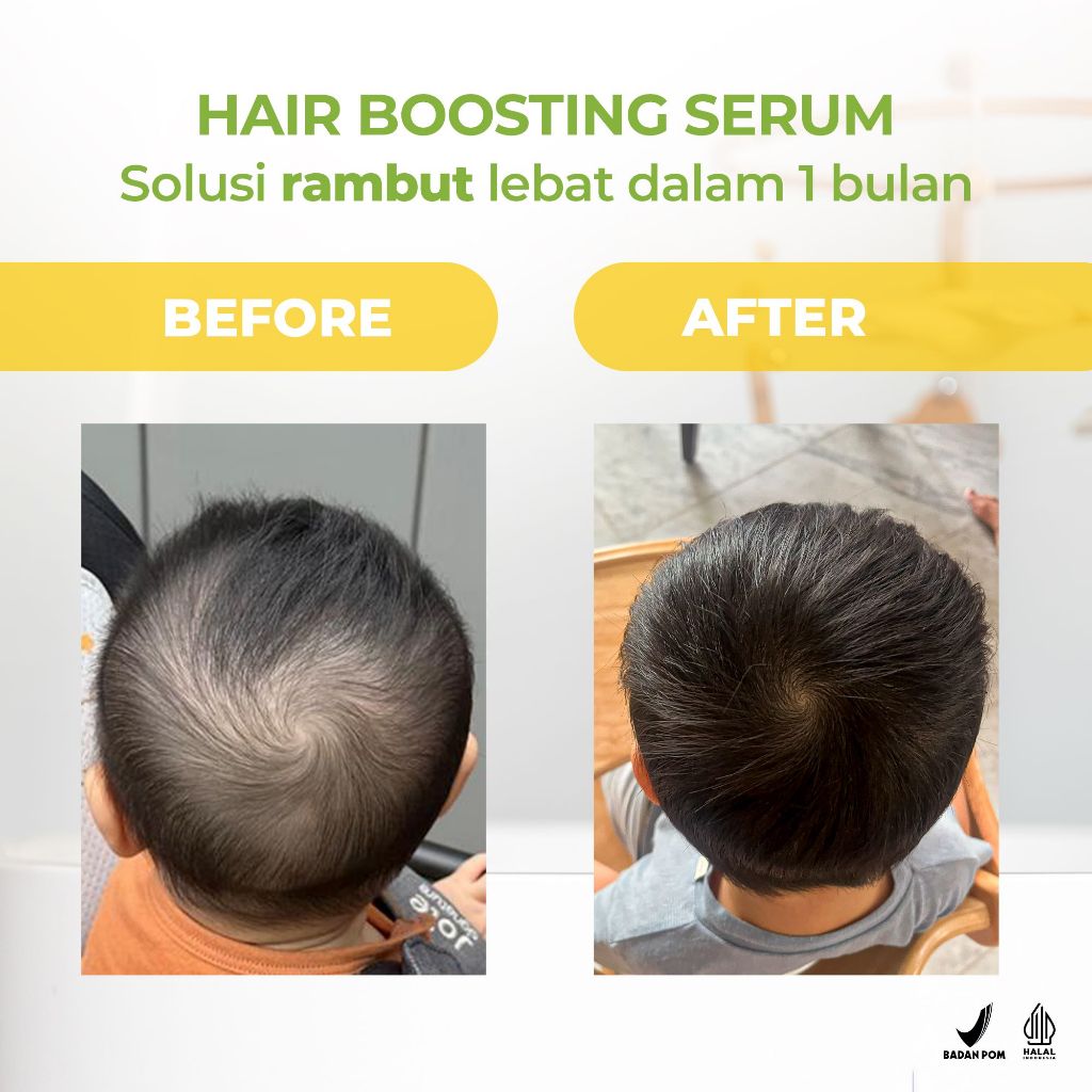Jual Baby Hair Boosting Serum | #1 dengan Biotin, Keratin & Kemiri ...