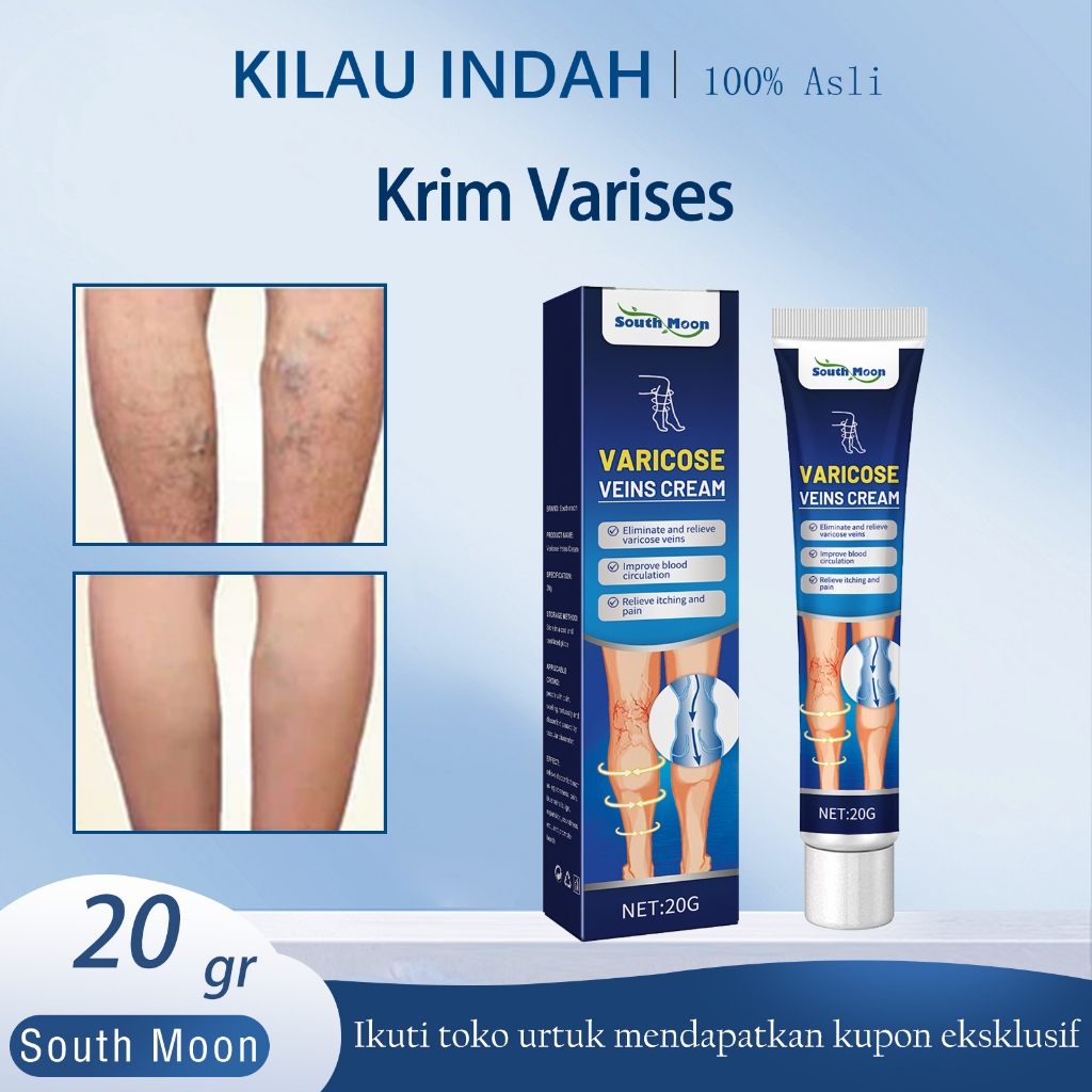 Jual Varicose Veins Cream 20g Obat Varises di Kaki salep varises obat ...