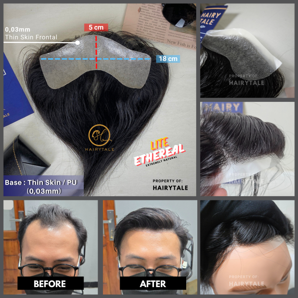 Jual Toupee / tutup botak jidat pria, Thin skin(0,03mm), ukuran 3x18 cm ...