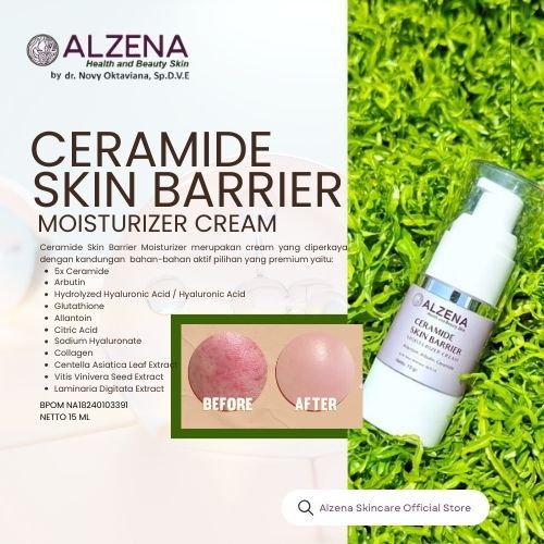 Jual ALZENA CERAMIDE Skin Barrier Moisturizer Cream - Memperbaiki Skin ...