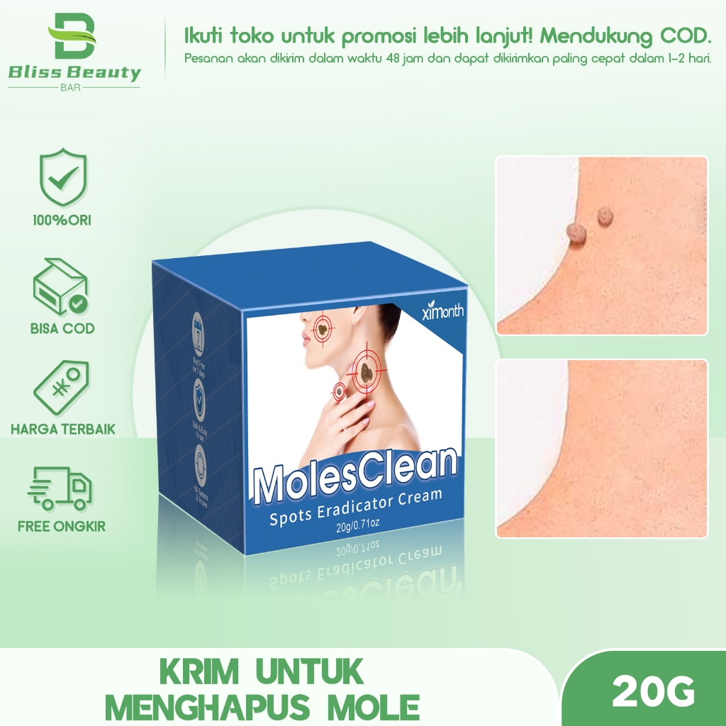 Jual Ximonth Moles Clean Spots Eradicator Cream 20g Mole Dan Wart ...