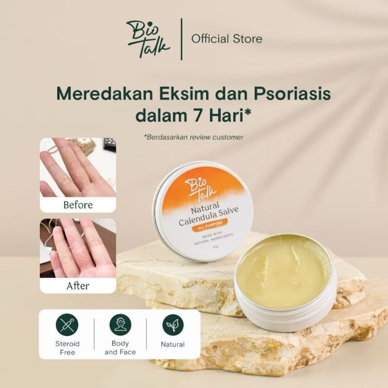 Jual BioTalk Healing Calendula Salve Salep Gatal eczema meredakan gatal ...