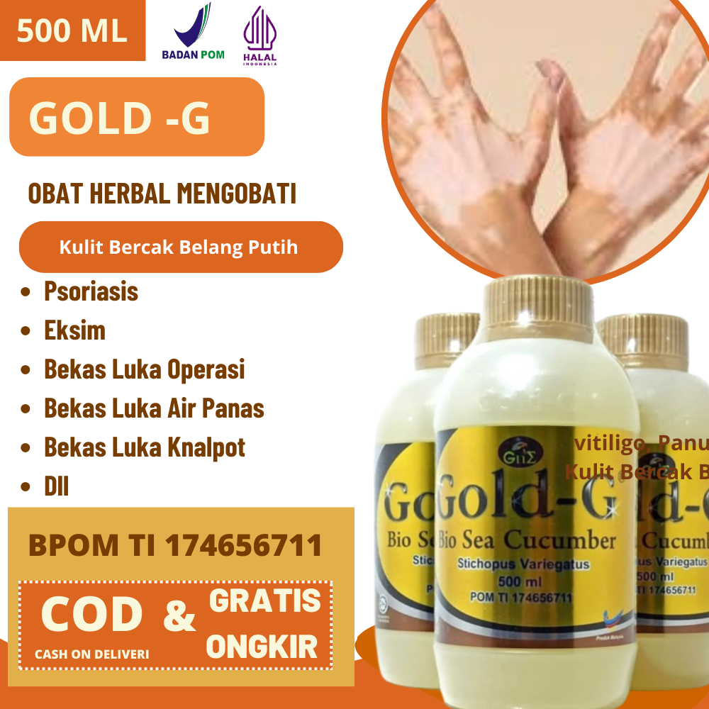 Jual GOLD-G// Obat Vitiligo Paling Ampuh Kulit Bercak Belang Putih Anak ...