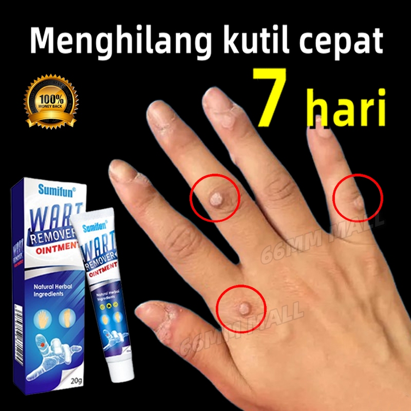Jual [100% Original]Sumifun penghilang kutil dan tahi lalat penghilang ...