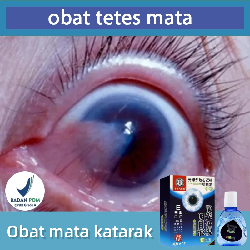 Jual obat mata katarak obat tetes mata merah tetes mata katarak Obat ...