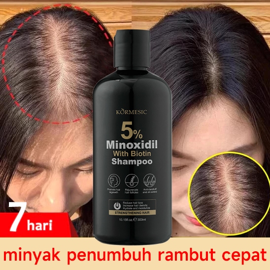 Jual Shampo Penumbuh Rambut Cepat 5% Minoxidil Shampoo 300ml Sampo pertumbuhan rambut ...