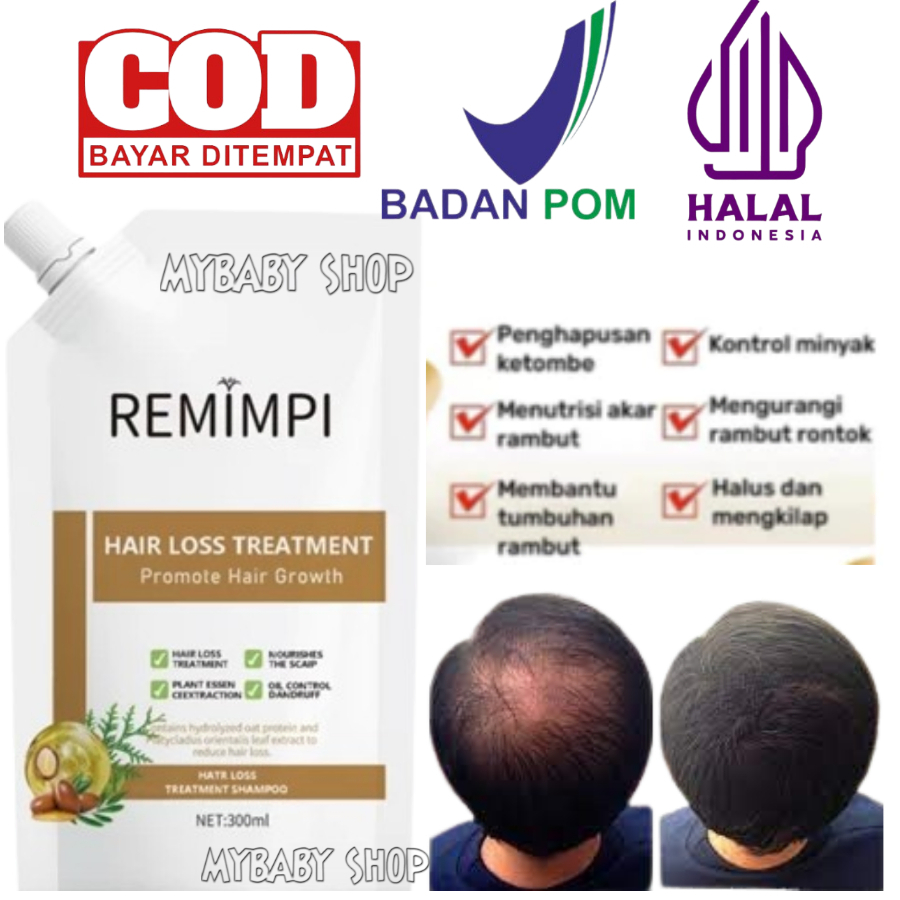 Jual remimpi shampo hair loss treatment mencegah rambut rontok ...