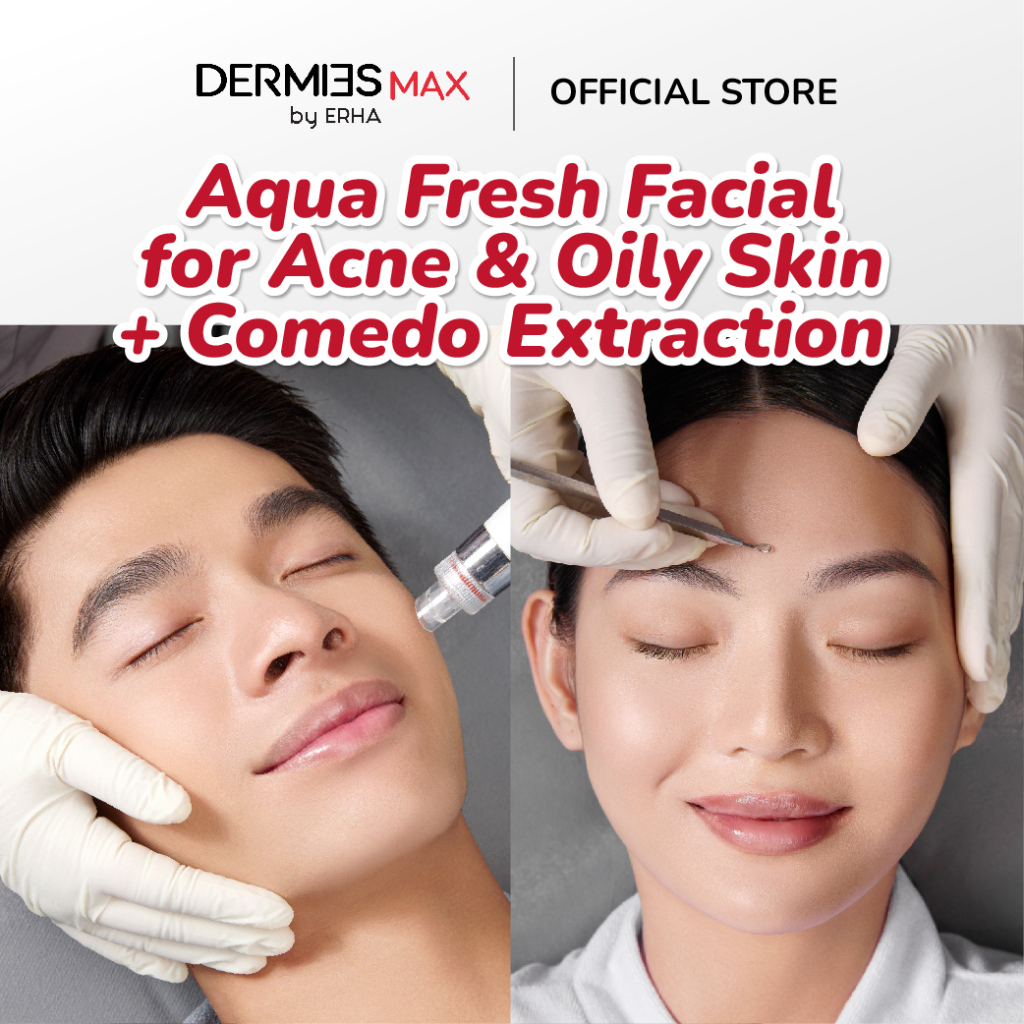 Jual Dermies Max Aqua Fresh Facial for Acne & Oily Skin + Comedo ...