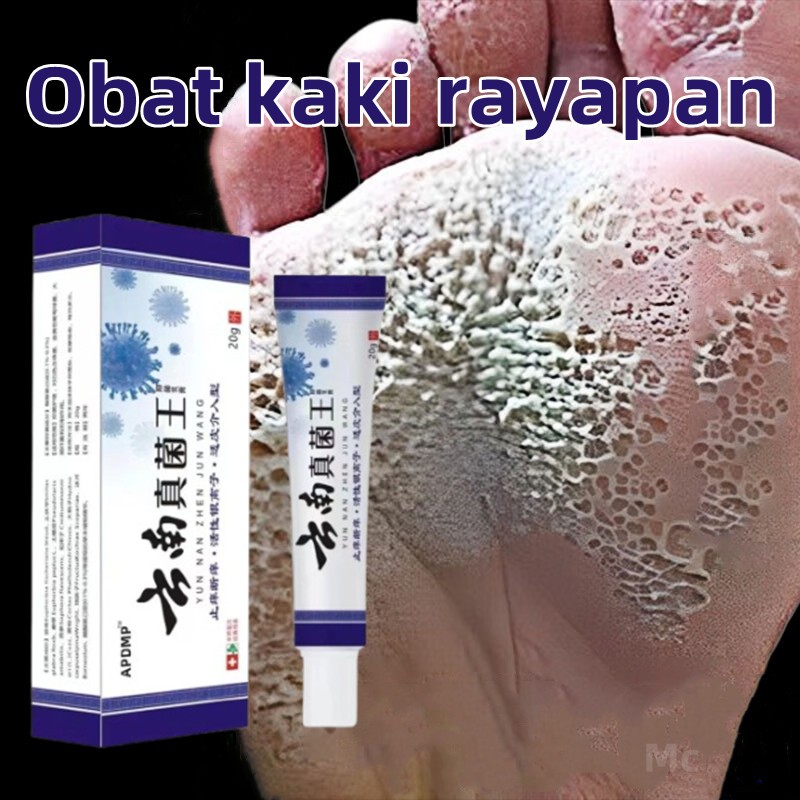 Jual Obat kaki rayapan Penghilang bau kaki Obat jamur kaki Obat gatal ...