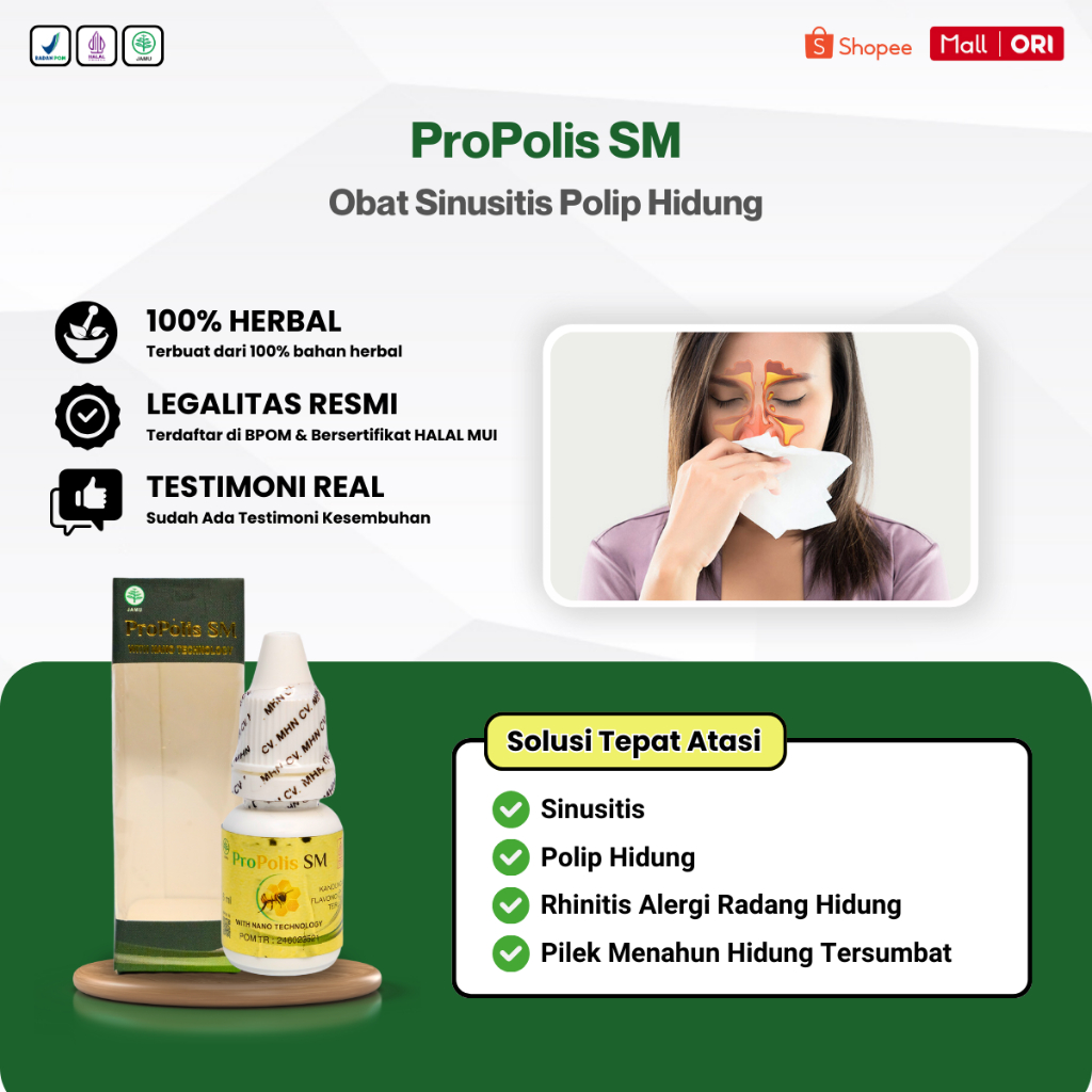 Jual Propolis SM - Obat Sinusitis Pilek Menahun Polip Hidung Rhinitis ...