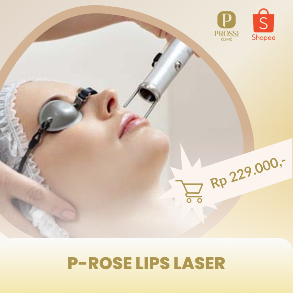 Jual P-ROSE LIPS LASER (Laser Bibir, rejuvenation, lip rejuv) - Prossi ...