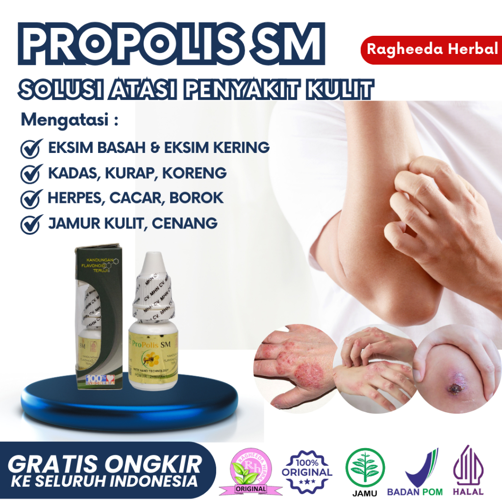 Jual Obat Eksim Basah & Eksim Kering, Kadas, Herpes, Kurap, Koreng ...