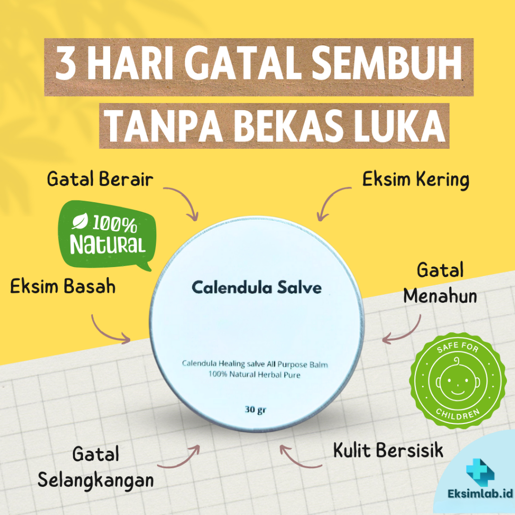 Jual Salep Eksim Exim Gatal Kulit Paling Ampuh Basah Kering Jamur Kulit ...