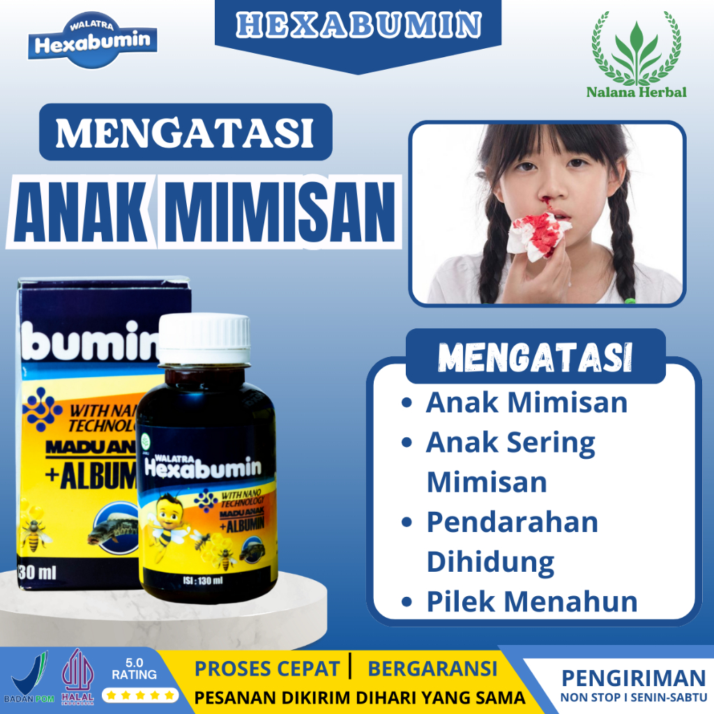 Jual Obat Anak Mimisan Anak Sering Mimisan Pendarahan Dihidung Pilek ...