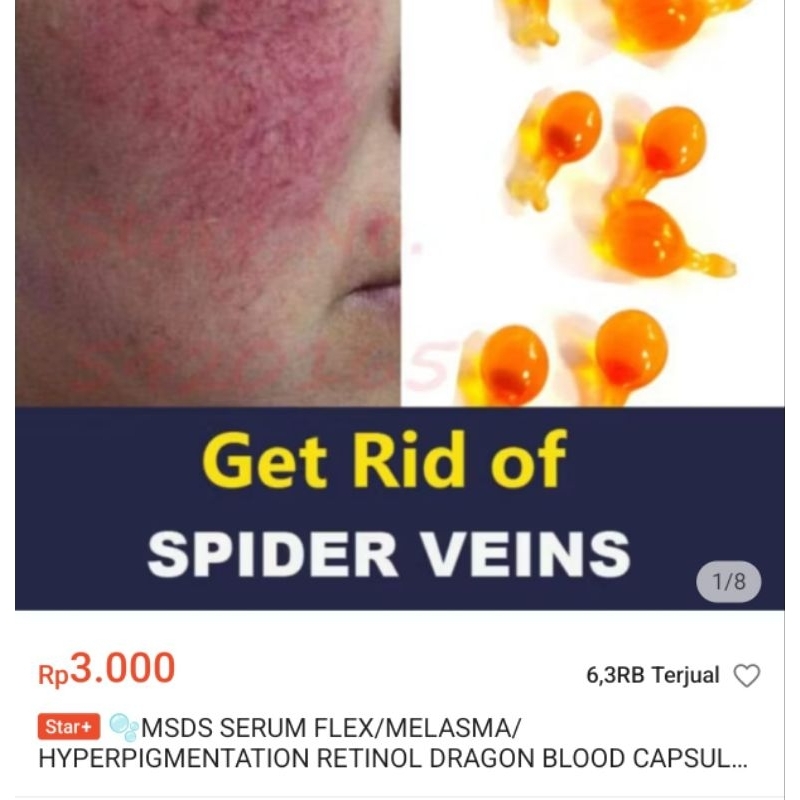 Jual SERUM FLEX/MELASMA/HYPERPIGMENTATION/SPIDER VEIN AMPUH POL! DRAGON ...