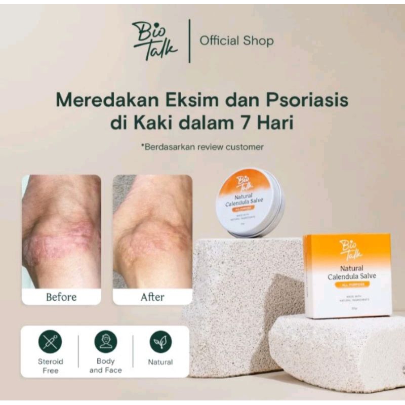 Jual BIO TALK BPOM Calendula Salve for eczema and dry skin Biotalk No ...