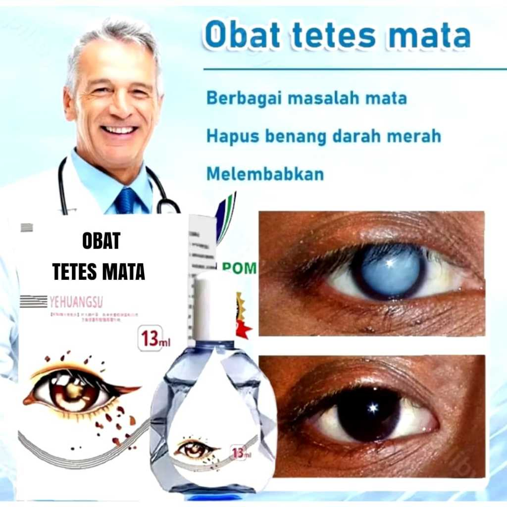 Jual Obat Tetes Mata Herbal Eye Drop Katarak Berlemak Buram Kabur ...