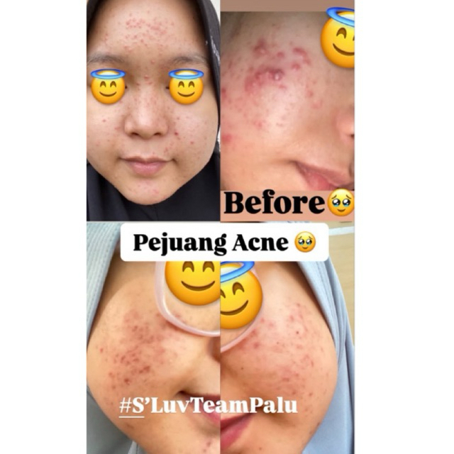 Jual S'LUV PERFECT SUNSCREEN 1pcs (10g) | Shopee Indonesia