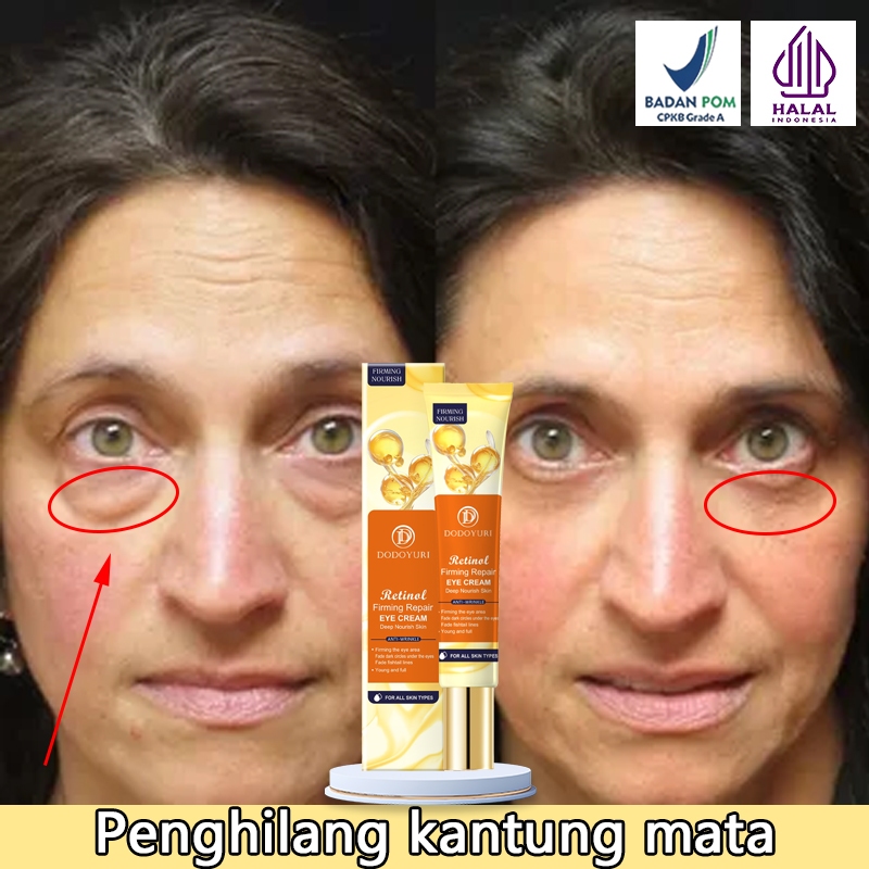 Jual Eye cream mata panda penghilang kantung mata menghilangkan mata ...